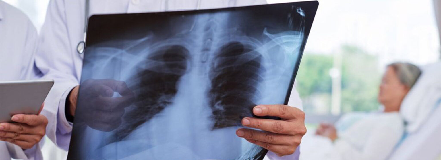 Seputar Pemeriksaan Radiologi, yang Perlu Anda Ketahui!